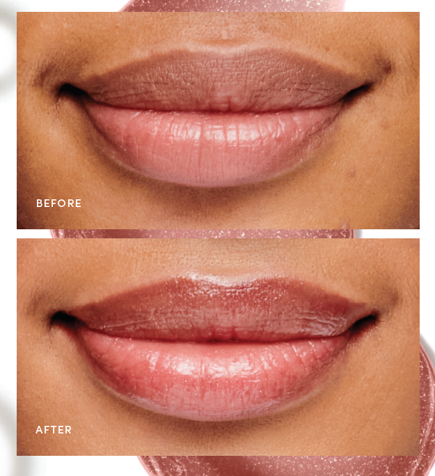 HydroPure Hyaluronic Lip Gloss | Totally Refreshed Steam and Spa